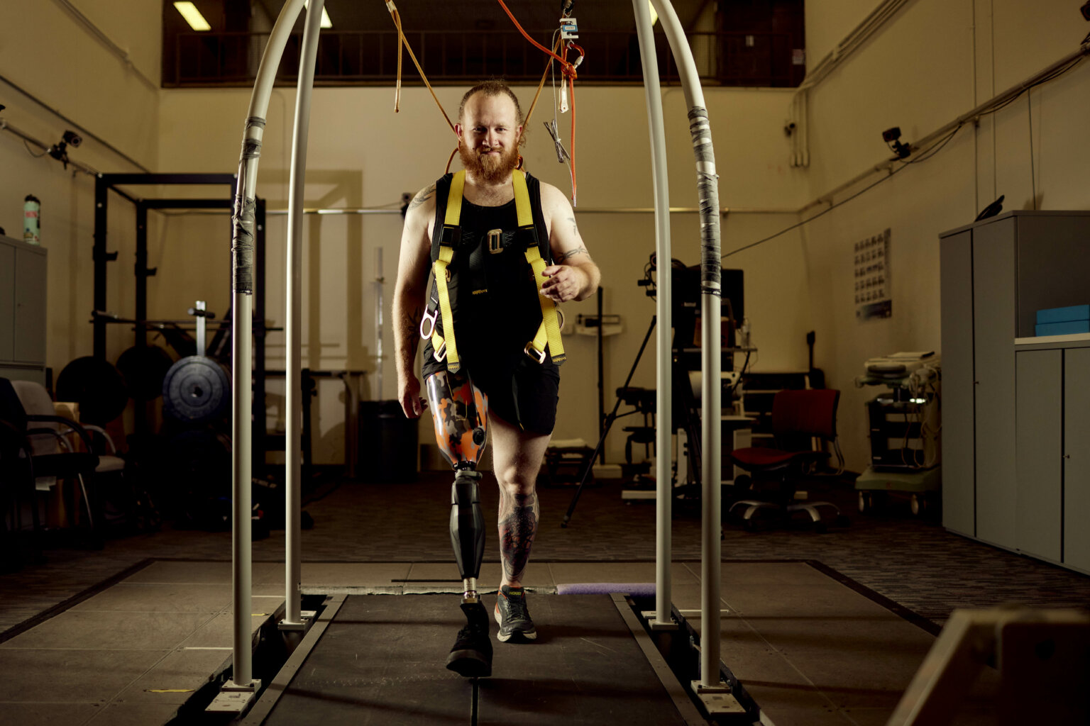 Exploring the Human Factor in Prosthetic Adaptation | Vicon